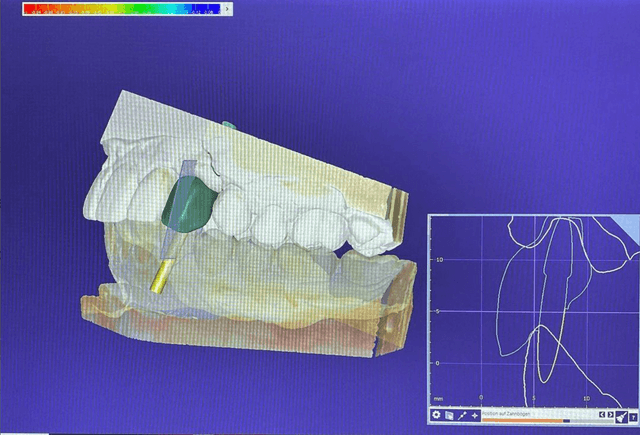 News | Felix Wick | Digitale Planung